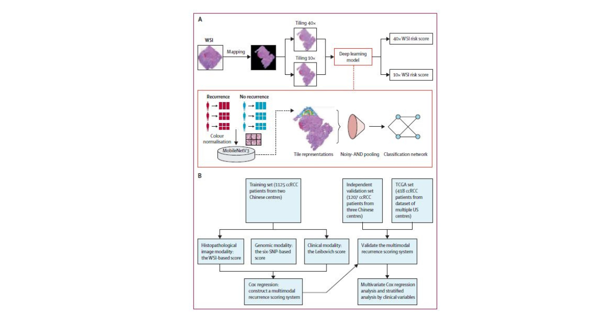 Multimodal recurrence scoring system for prediction of clear cell renal cell carcinoma outcome ...