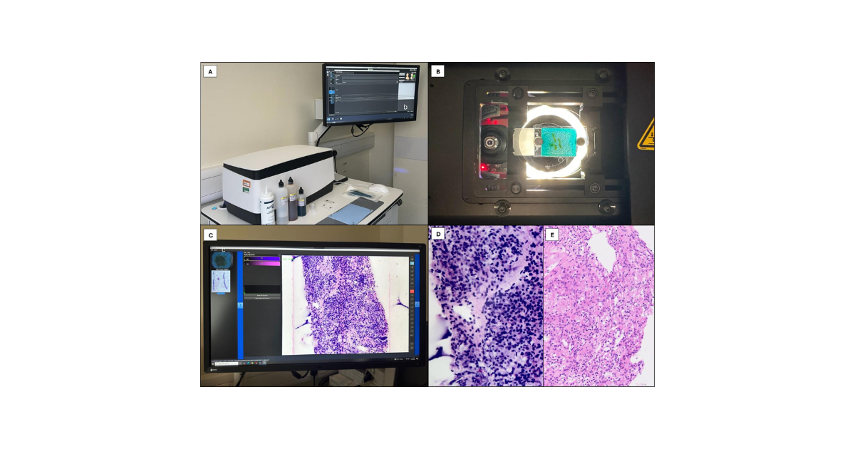 Cambridge kidney One-Stop Mass Investigation Clinic (CkOSMIC): A ...